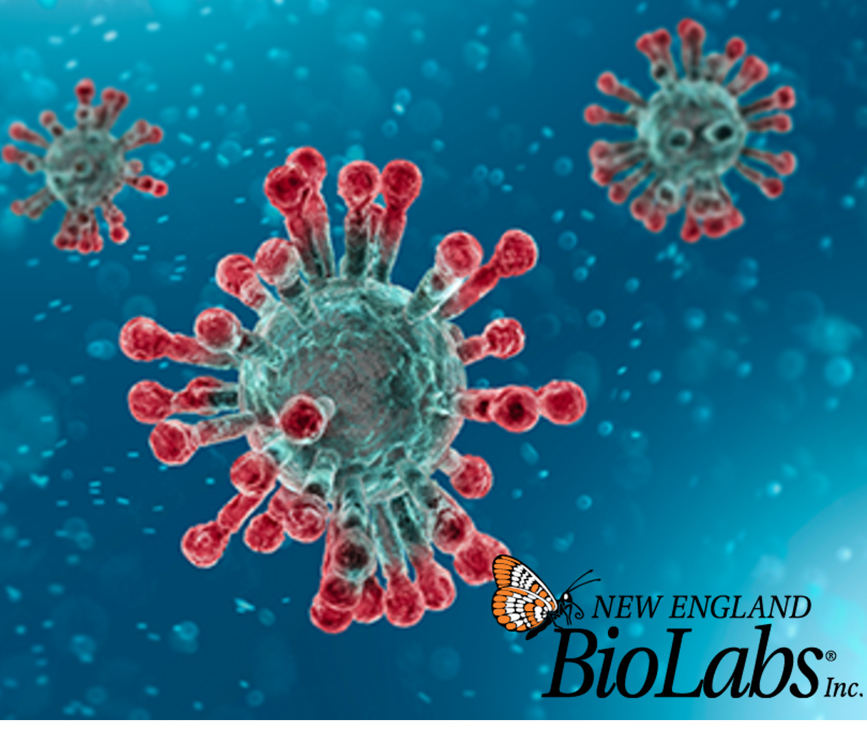 NEB Monarch® Total RNA Miniprep kit a koronavírus elleni harcban ...